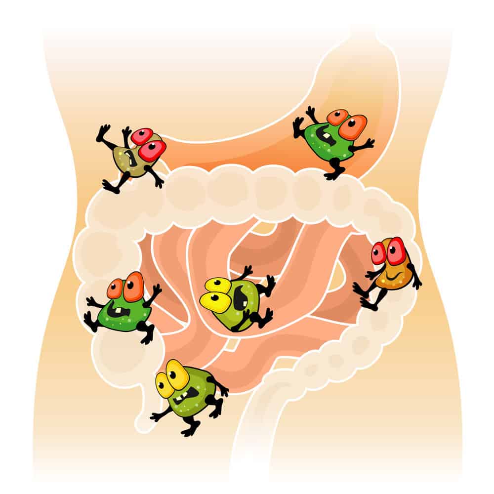 What Is a Leaky Gut?